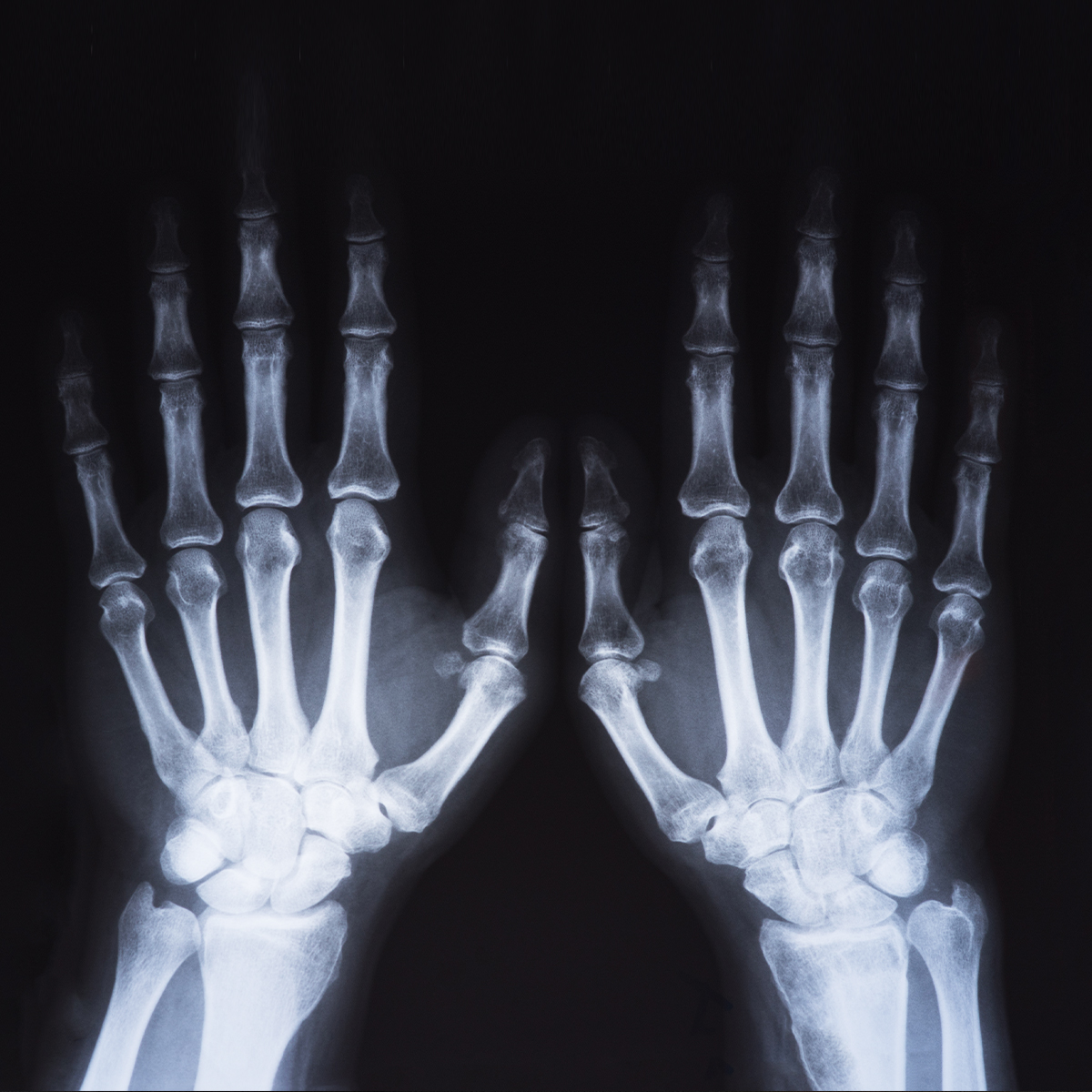 Rx polso - Centro Medico Filippi