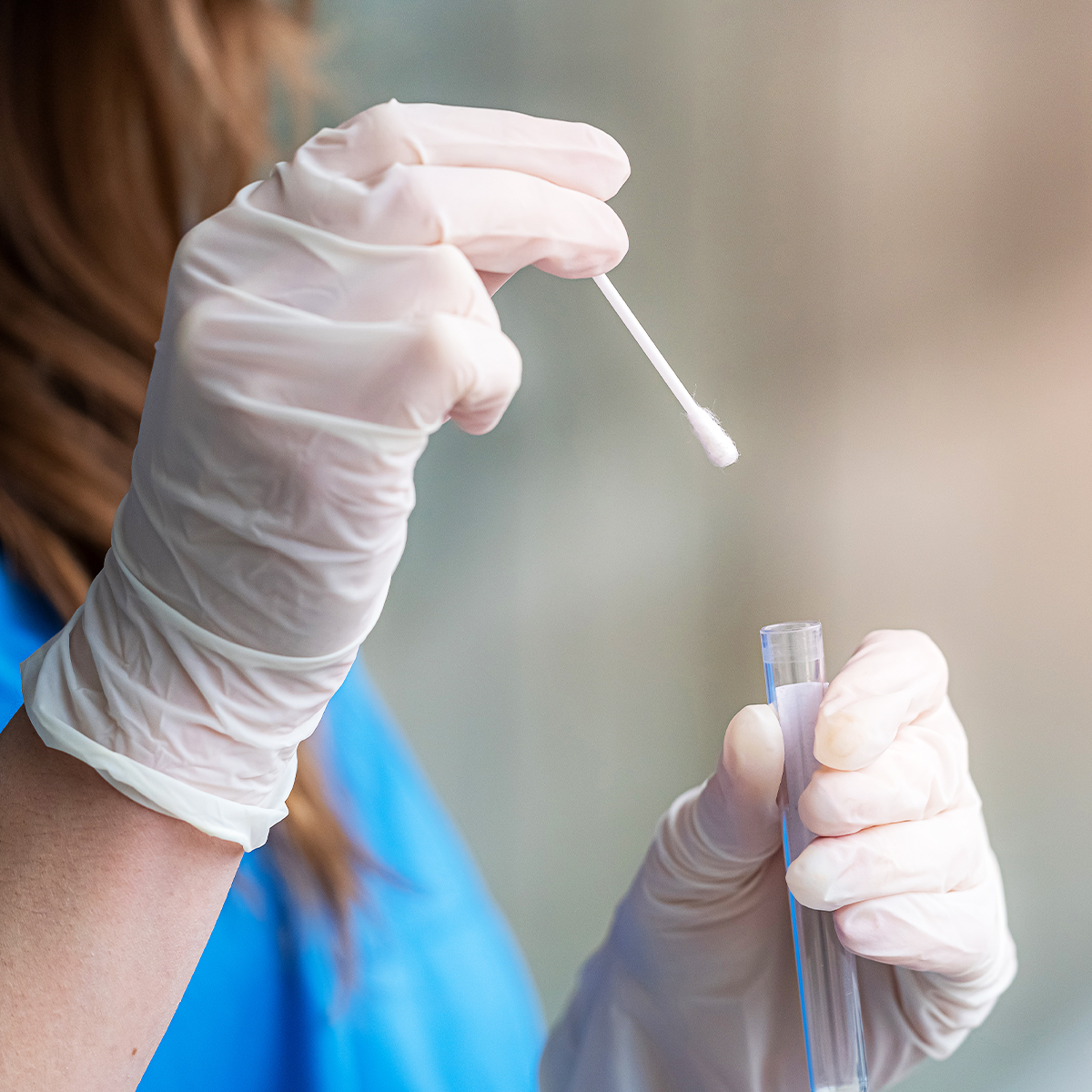 Tamponi vaginali e cervicali - Centro Medico Filippi